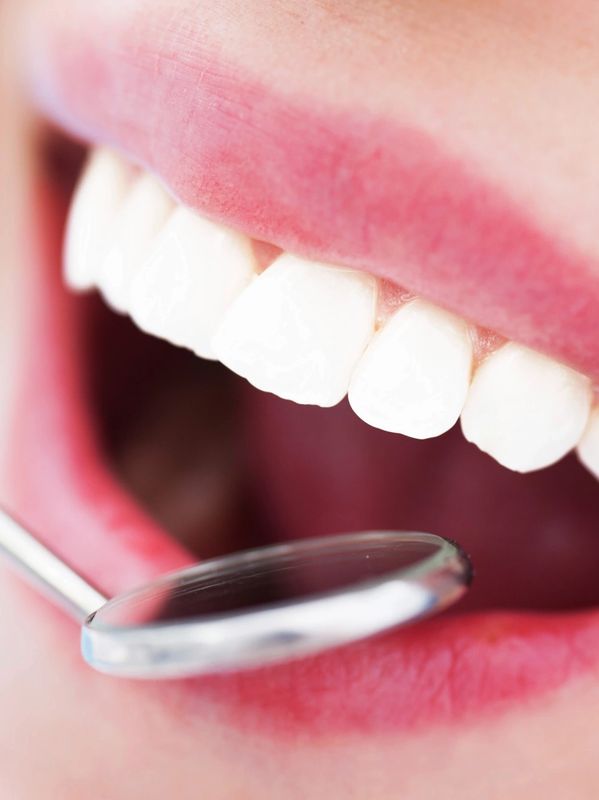 Oral Facial Myology / Myofunctional Therapy