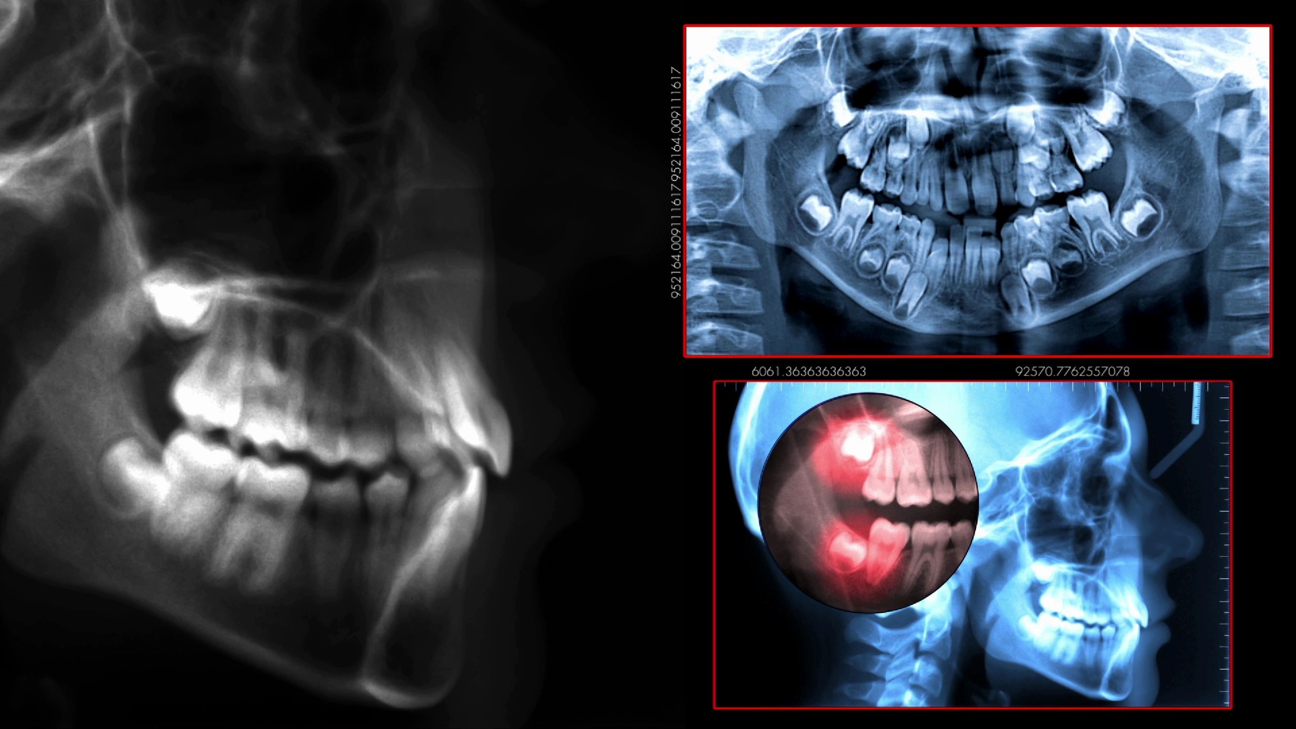 Precision Dental Imaging