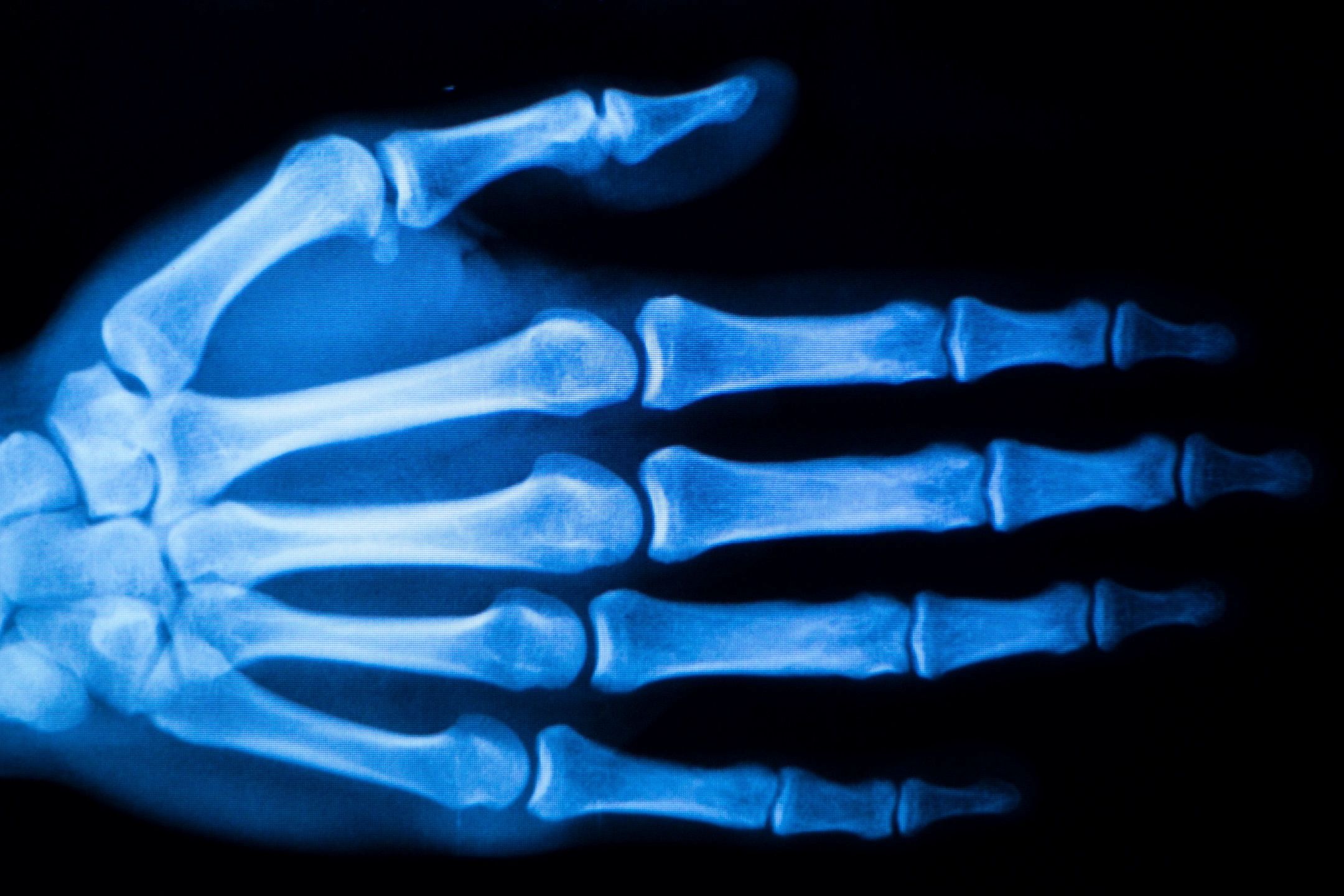 Michael Aron Hand Surgery - Hand Surgery, Orthopedic Surgery