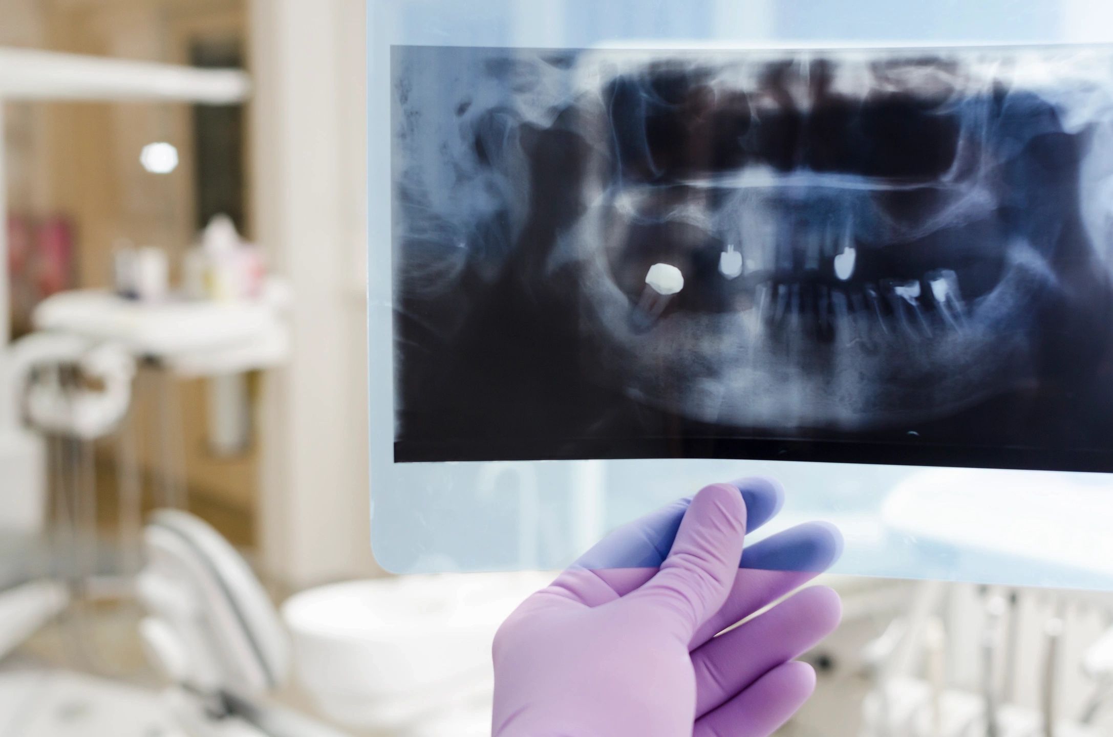 Southwest Dental Refining - Dental Scrap, Crowns, PFMs, Gold