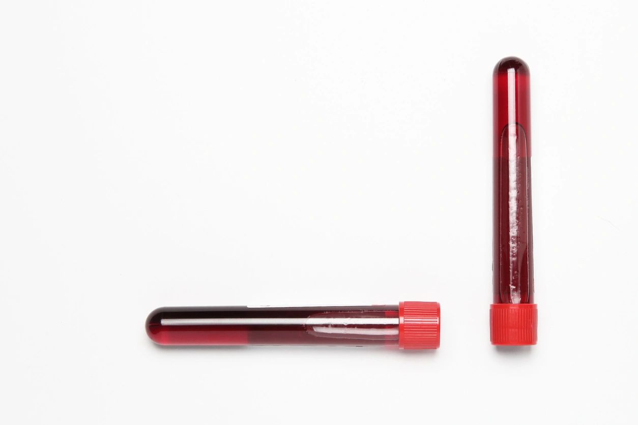 The Crucial Role of Laboratory Testing in Achieving Wellness