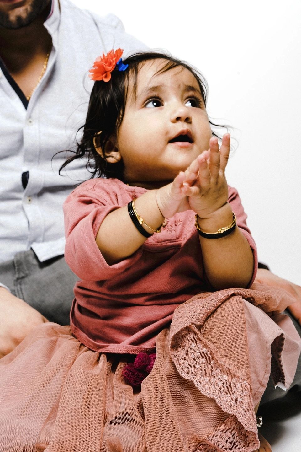 Osteogenesis Imperfecta Baby